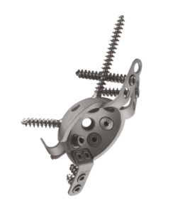 Hip | USA United Orthopedic Corporation | Hip and Knee Implants